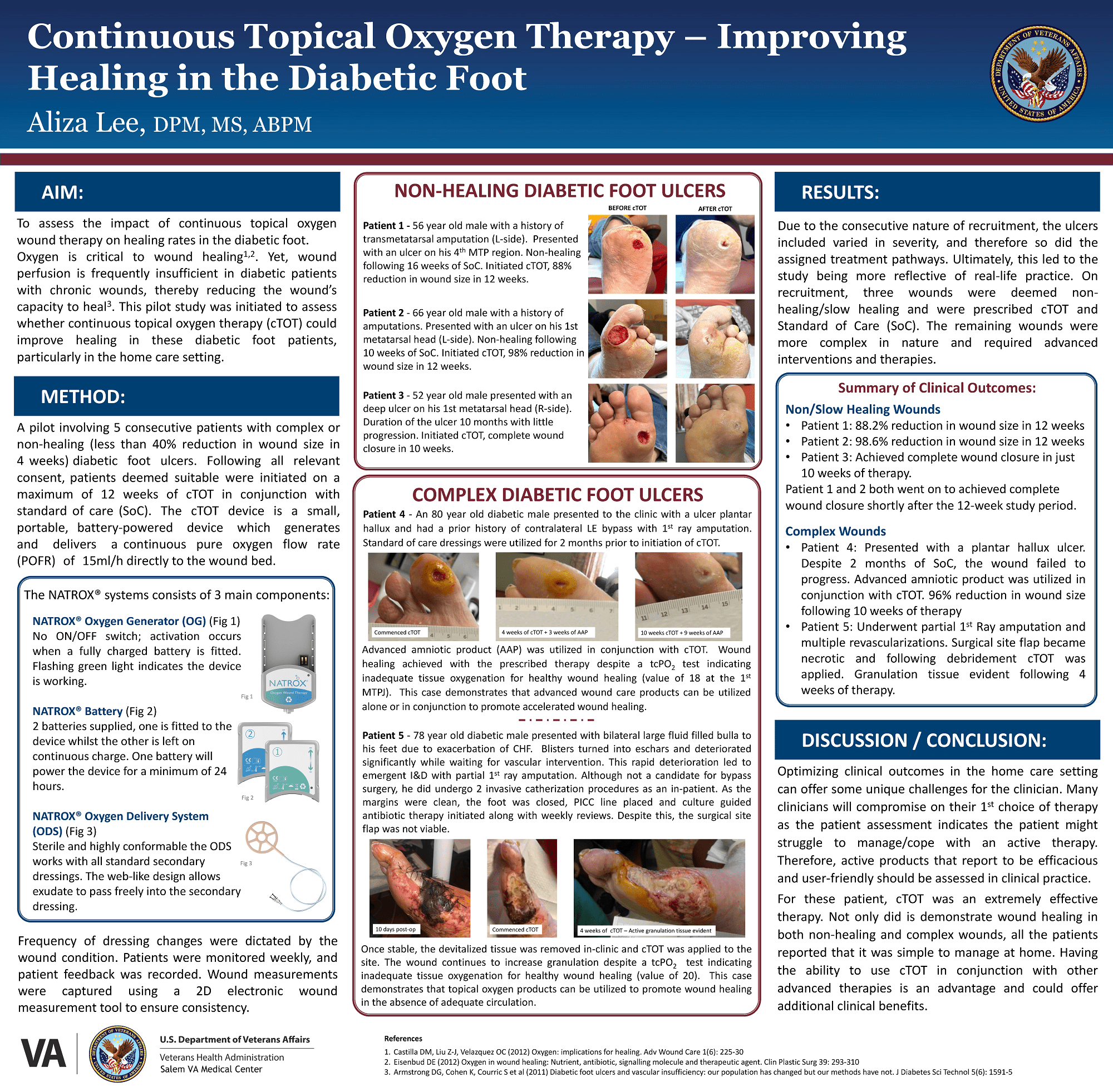 Poster presented at DFCon 2021 by Dr. Aliza Lee - NATROX® Wound Care ...